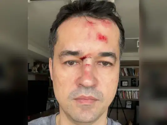 Deltan posta foto com rosto muito machucado e gera especulação, veja o ...